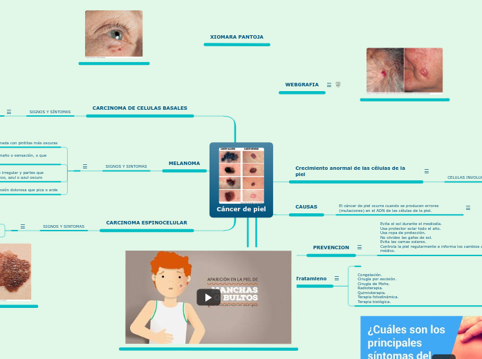 Cáncer de piel - Mind Map